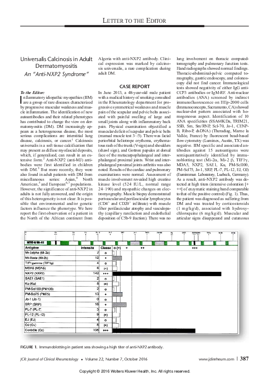 (PDF) Universalis Calcinosis in Adult Dermatomyositis