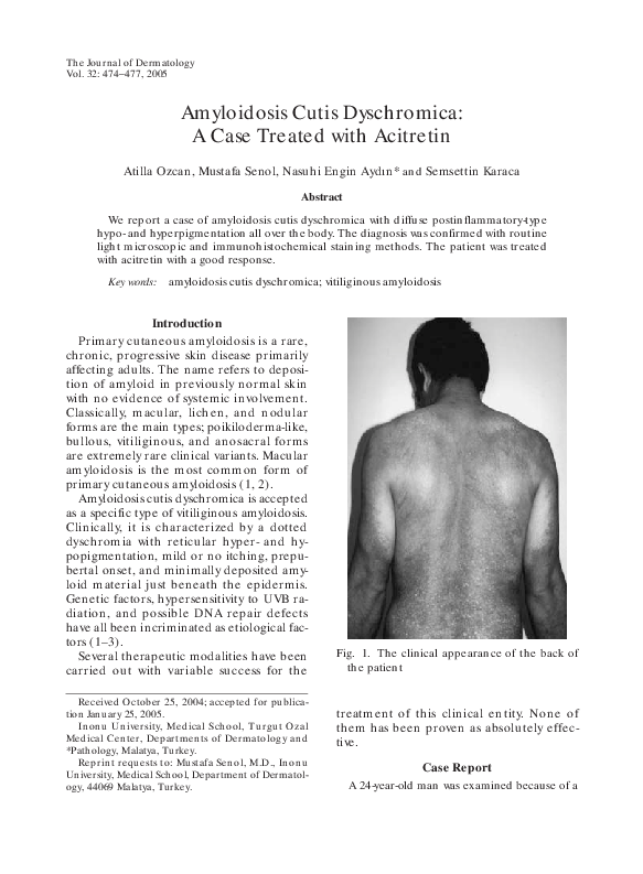 (PDF) Amyloidosis Cutis Dyschromica: A Case Treated with Acitretin ...
