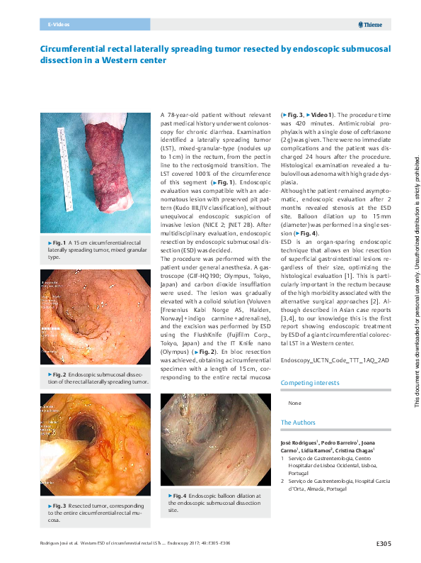 (PDF) Circumferential rectal laterally spreading tumor resected by ...