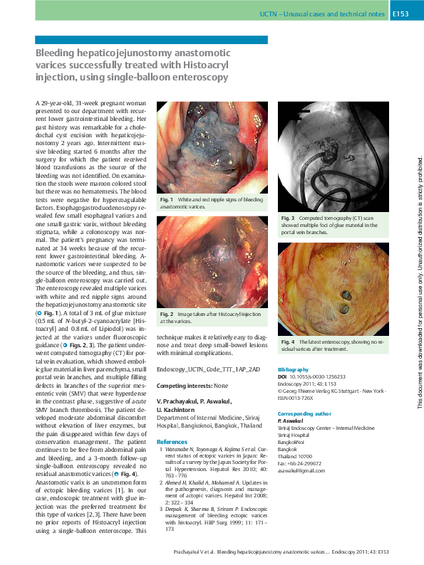 (PDF) Bleeding hepaticojejunostomy anastomotic varices successfully ...