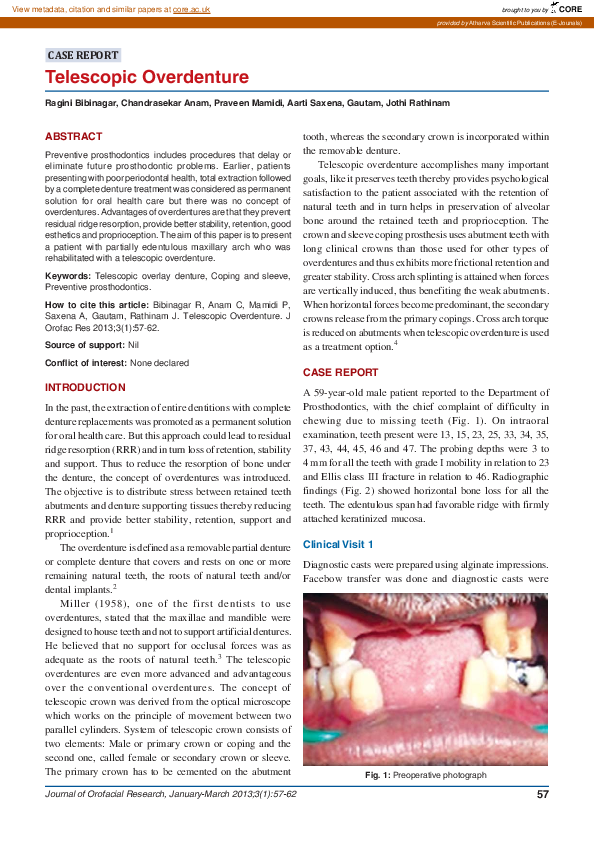 (PDF) Telescopic Overdenture