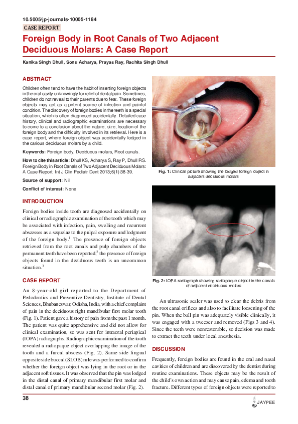 (PDF) Foreign Body in Root Canals of Two Adjacent Deciduous Molars: A ...