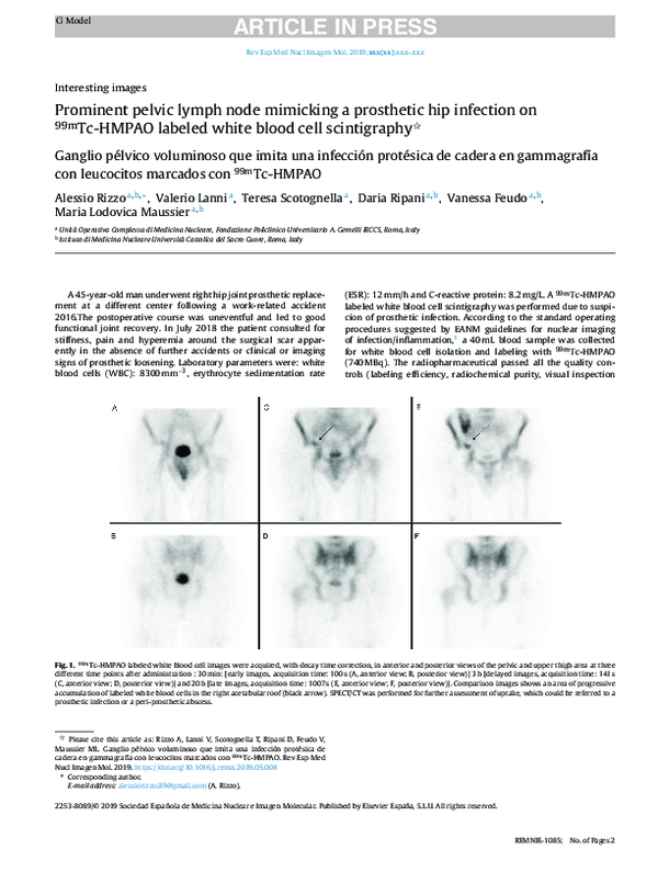(PDF) Prominent pelvic lymph node mimicking a prosthetic hip infection ...