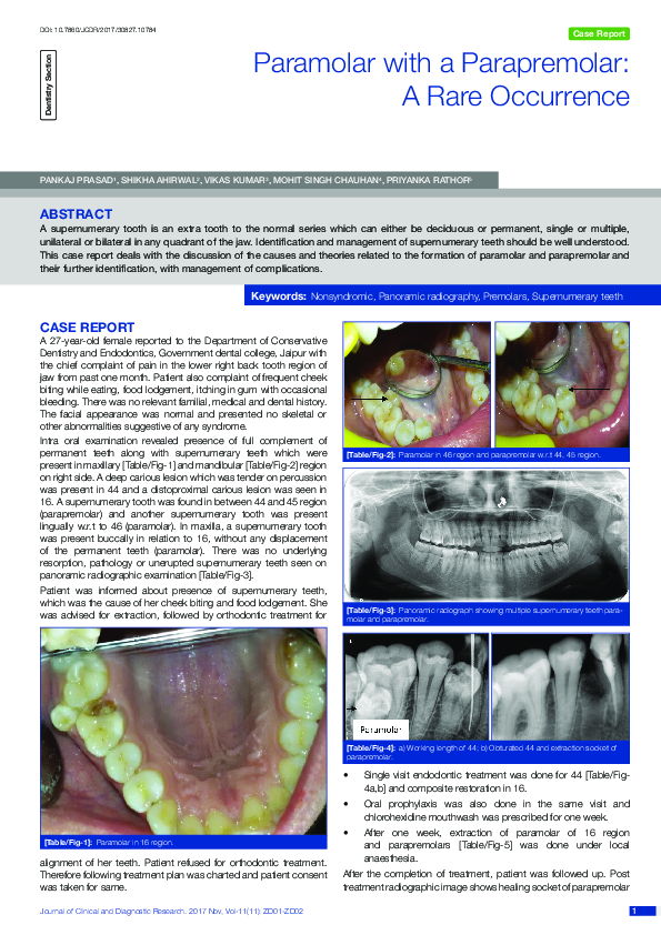 (PDF) Paramolar with a Parapremolar: A Rare Occurrence