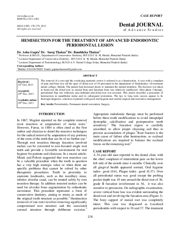(PDF) Hemisection for treatment of an advanced endodontic-periodontal ...