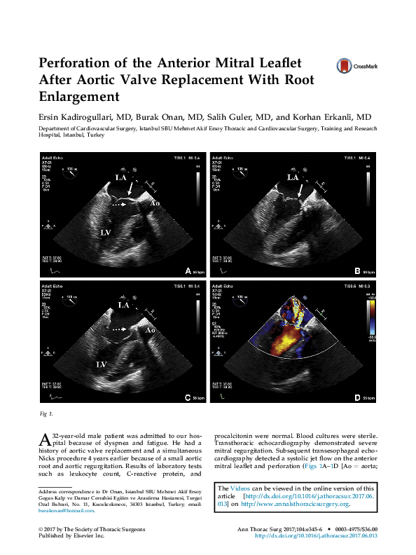 (PDF) Perforation of the Anterior Mitral Leaflet After Aortic Valve ...