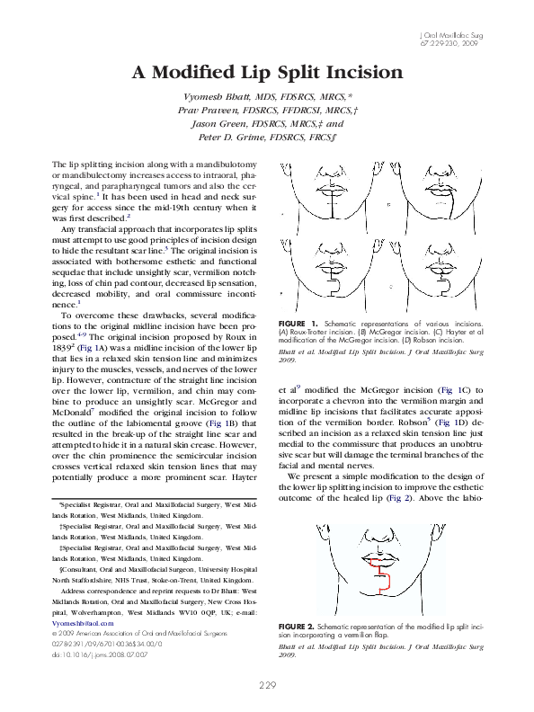 (PDF) A Modified Lip Split Incision | Jason Green - Academia.edu