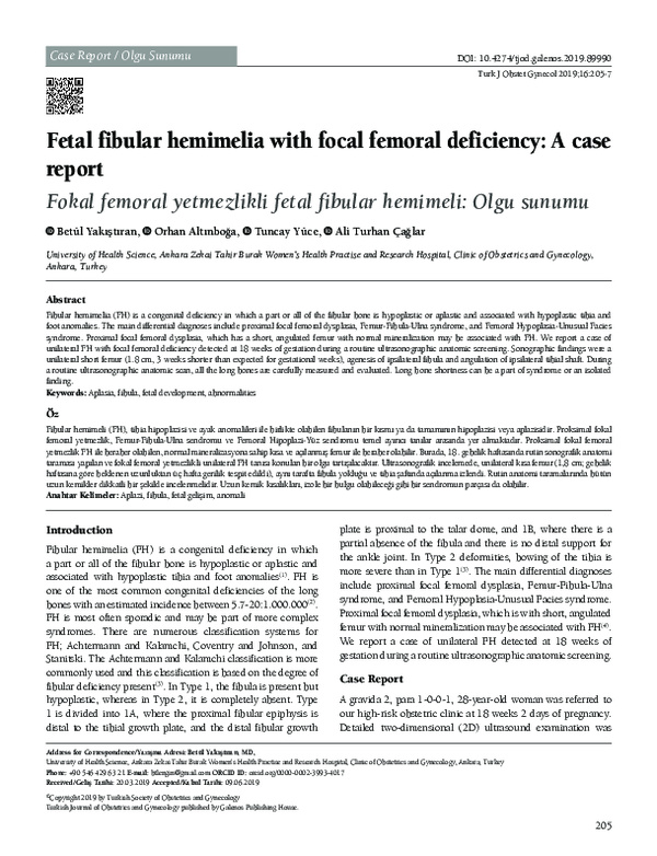 (PDF) Fetal fibular hemimelia with focal femoral deficiency: A case report