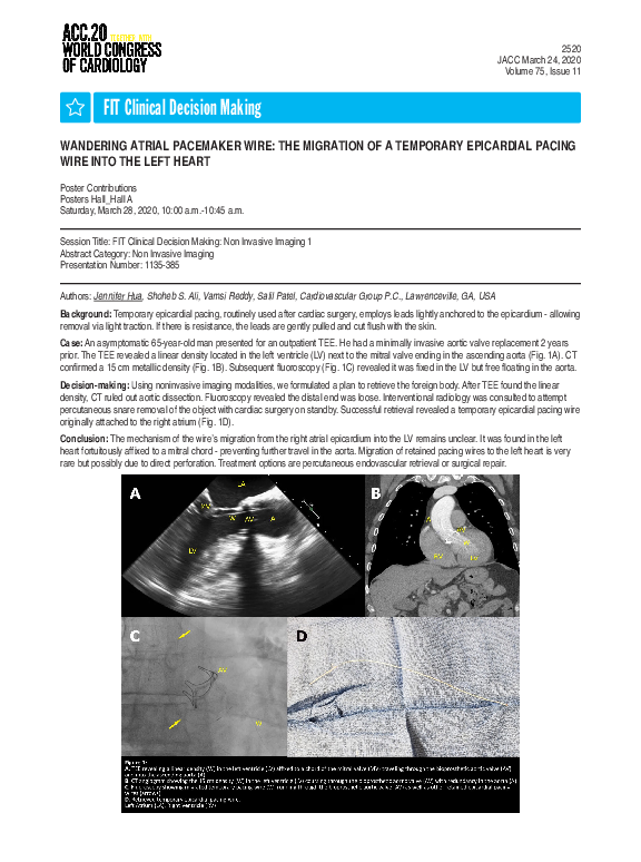 (PDF) Wandering Atrial Pacemaker Wire: The Migration of a Temporary ...