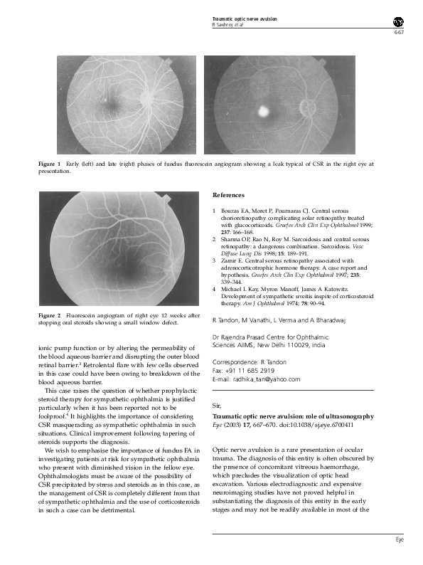(PDF) Traumatic optic nerve avulsion: role of ultrasonography | Rajeev ...