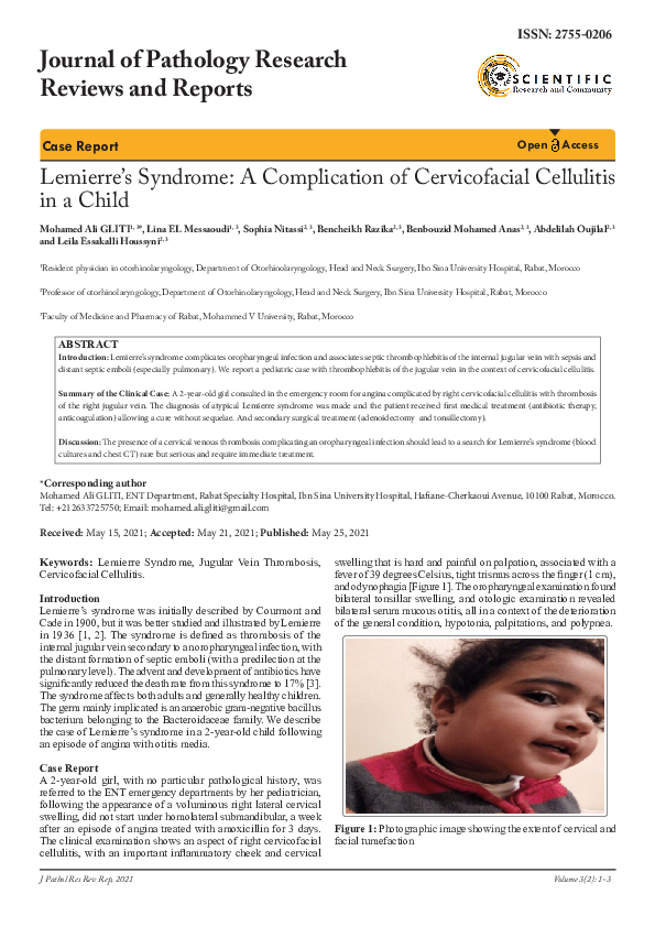 (PDF) Lemierre’s Syndrome: A Complication of Cervicofacial Cellulitis ...