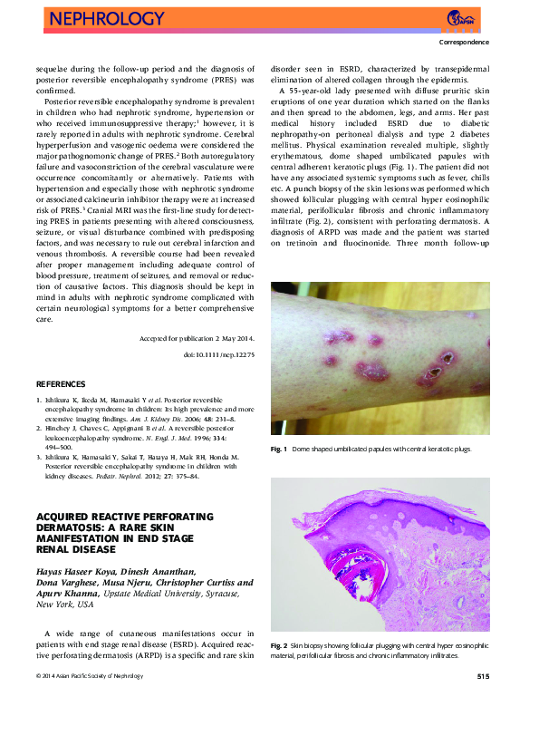 (PDF) Acquired Reactive Perforating Dermatosis: A Rare Skin ...