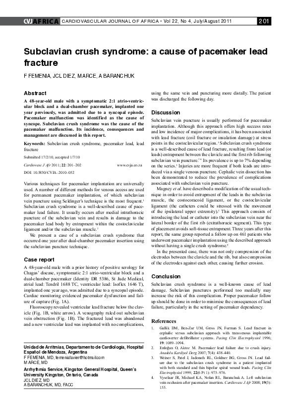(PDF) Subclavian crush syndrome : a cause of pacemaker lead fracture