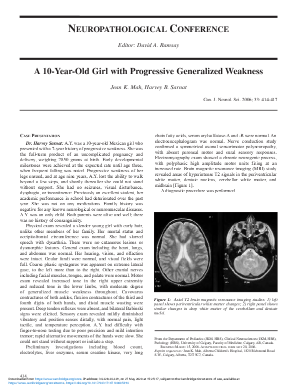 (PDF) A 10-Year-Old Girl with Progressive Generalized Weakness
