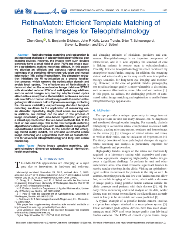 (PDF) RetinaMatch: Efficient Template Matching of Retina Images for ...
