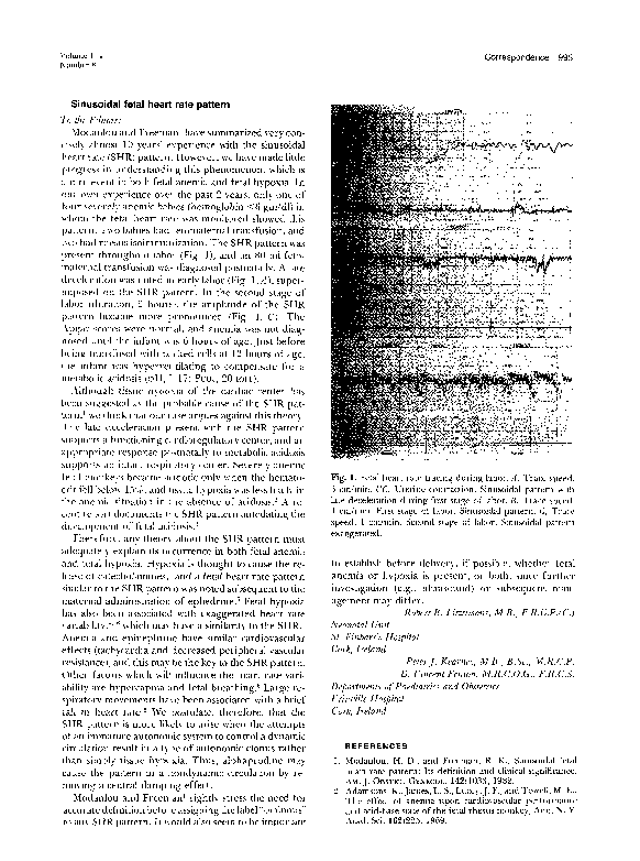 (PDF) Sinusoidal fetal heart rate pattern | Peter J. Kearney - Academia.edu