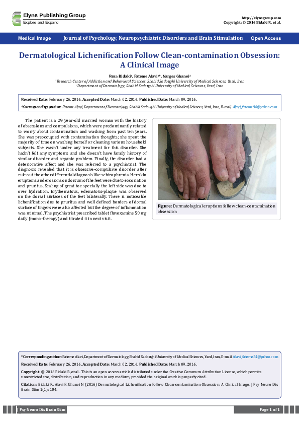 (PDF) Lichenification in OCD: A Clinical Case Study