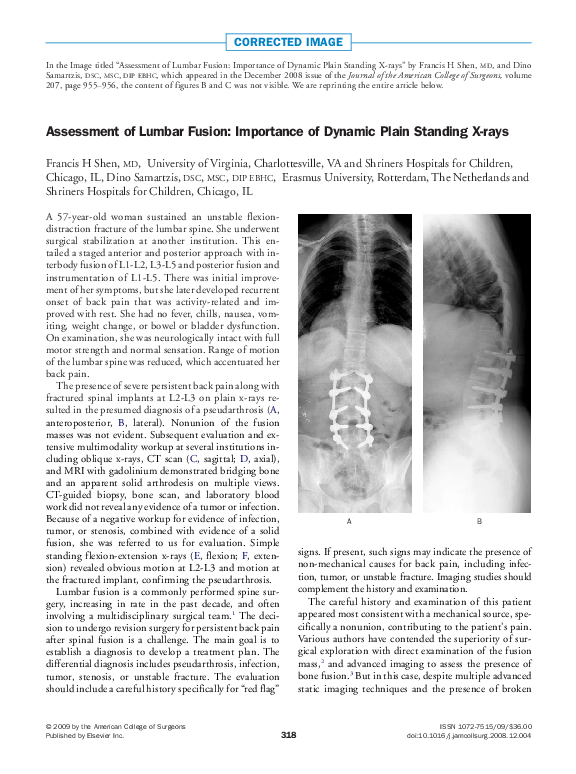 (PDF) Assessment of Lumbar Fusion: Importance of Dynamic Plain Standing ...