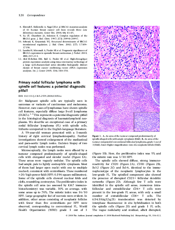(PDF) Primary nodal follicular lymphoma with spindle cell features: a ...