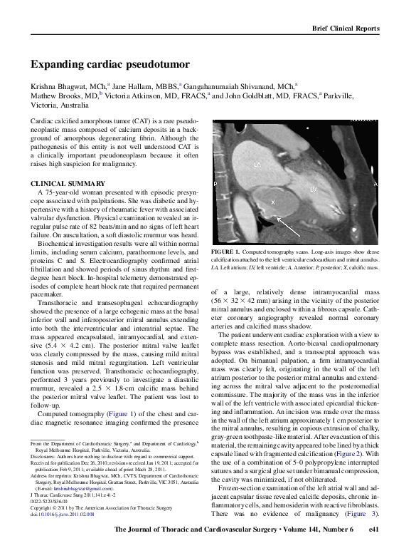 (PDF) Expanding cardiac pseudotumor | John Goldblatt - Academia.edu