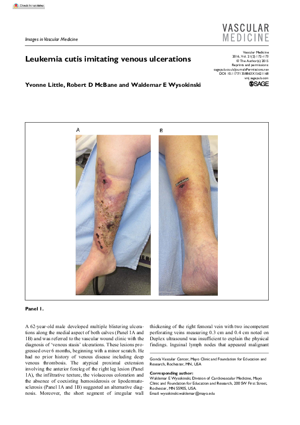(PDF) Leukemia cutis imitating venous ulcerations