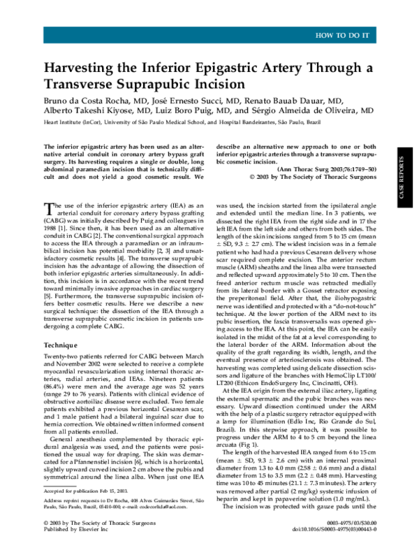 (PDF) Harvesting the inferior epigastric artery through a transverse ...