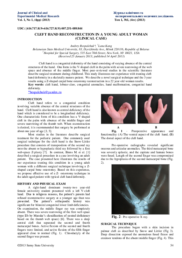 (PDF) Cleft Hand Reconstruction in a Young Adult Woman (Clinical Case)