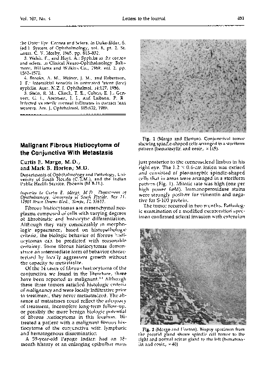 (PDF) Malignant fibrous histiocytoma of the conjunctiva | Sumit Monga ...