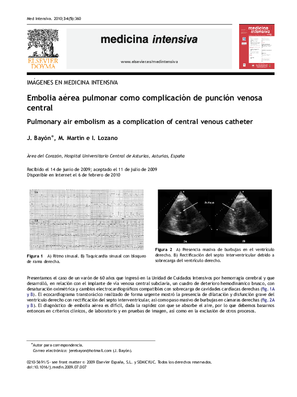(PDF) Embolia aérea pulmonar como complicación de punción venosa central