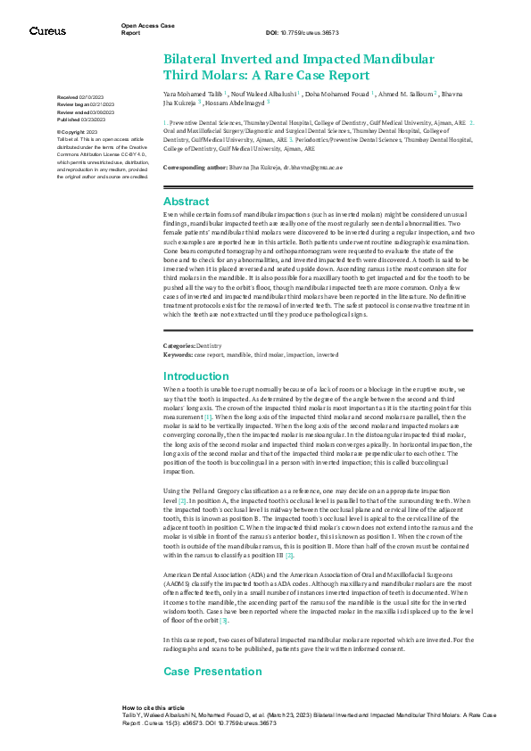 (PDF) Bilateral Inverted and Impacted Mandibular Third Molars: A Rare ...