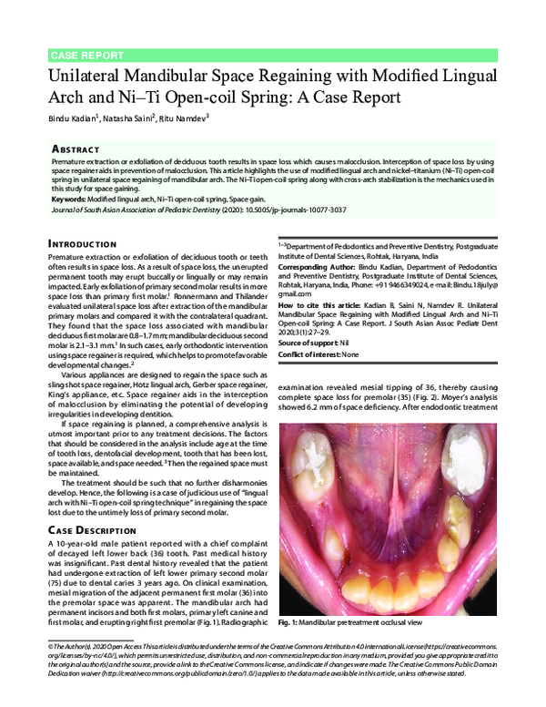 (PDF) Unilateral Mandibular Space Regaining with Modified Lingual Arch ...