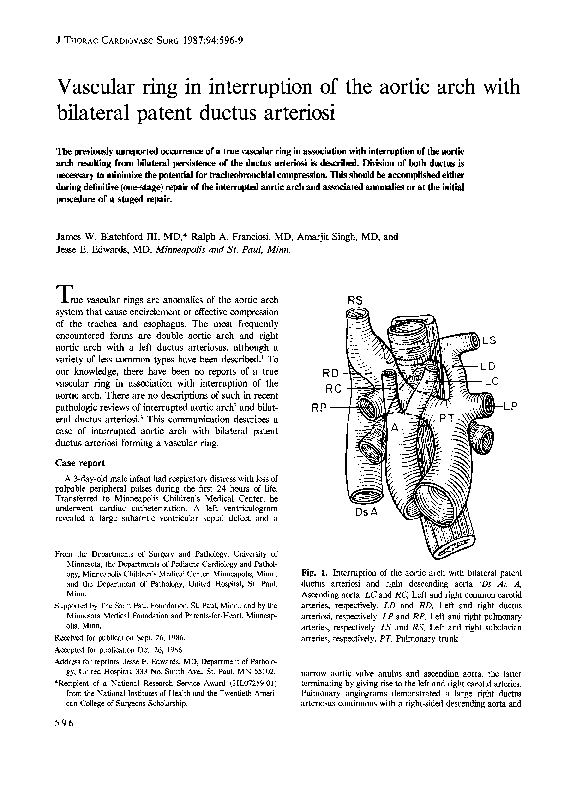 (PDF) Vascular ring in interruption of the aortic arch with bilateral ...