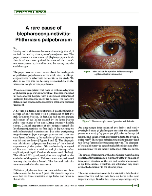 (PDF) A rare cause of blepharoconjunctivitis: Phthiriasis palpebrarum ...