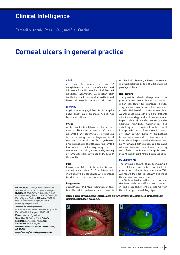 (PDF) Corneal ulcers in general practice