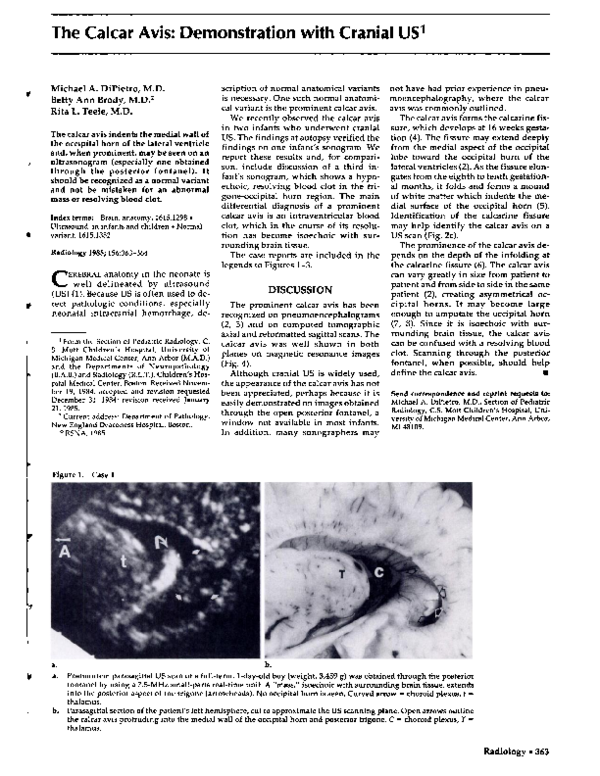 (PDF) The calcar avis: demonstration with cranial US