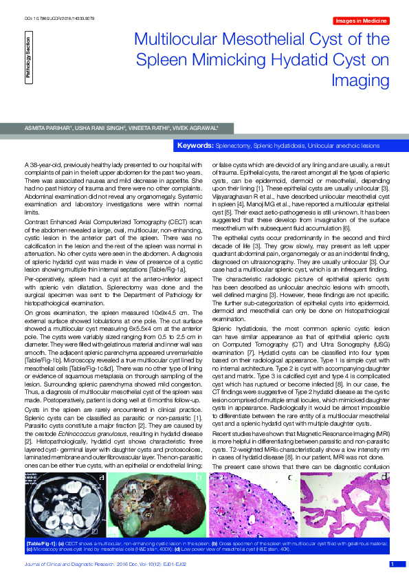 (PDF) Multilocular Mesothelial Cyst of the Spleen Mimicking Hydatid ...