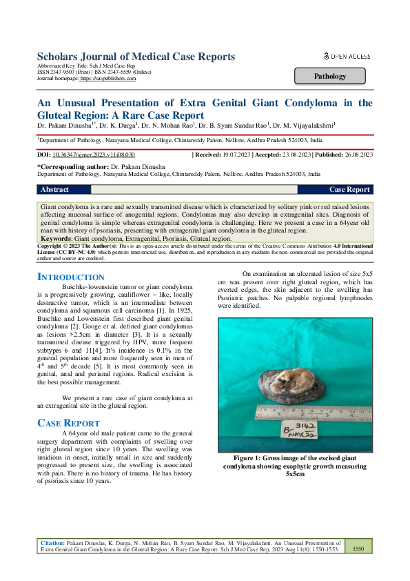 (PDF) An Unusual Presentation of Extra Genital Giant Condyloma in the ...