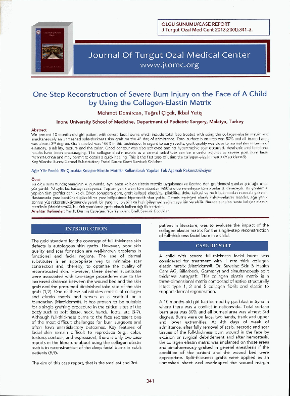 (PDF) One-Step Reconstruction of Severe Burn Injury on the Face of A ...