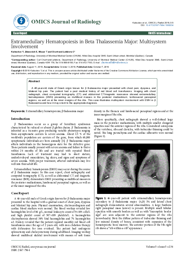(PDF) Extramedullary Hematopoiesis in Beta Thalassemia Major ...
