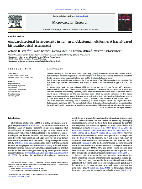 (PDF) Angioarchitectural heterogeneity in human glioblastoma multiforme ...