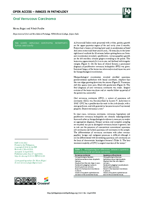 (PDF) Oral Verrucous Carcinoma