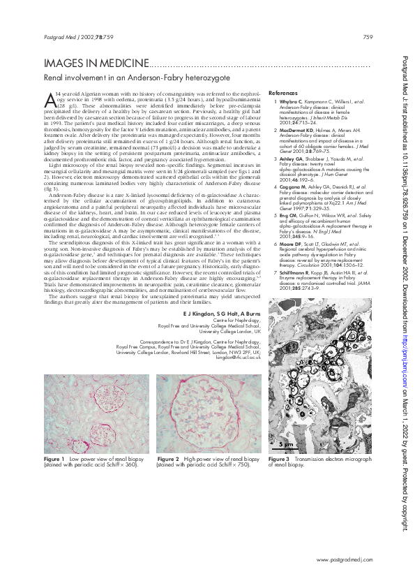 (PDF) Renal involvement in an Anderson-Fabry heterozygote | Aine Burns ...