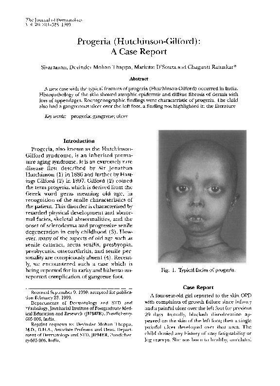 (PDF) Progeria (Hutchinson‐Gilford): A Case Report