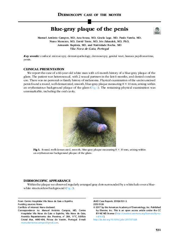 (PDF) Blue-gray plaque of the penis