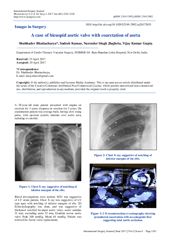 (PDF) A case of bicuspid aortic valve with coarctation of aorta