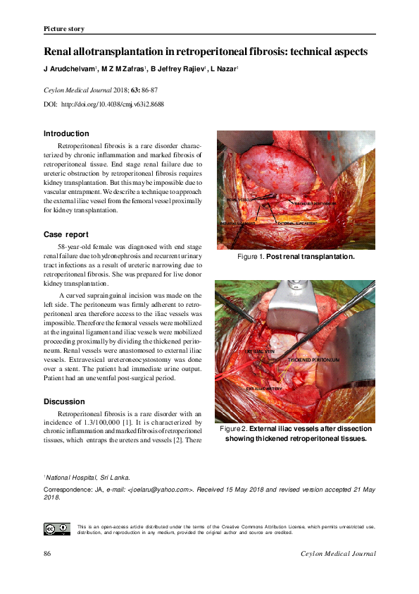 (PDF) Renal allotransplantation in retroperitoneal fibrosis: technical ...
