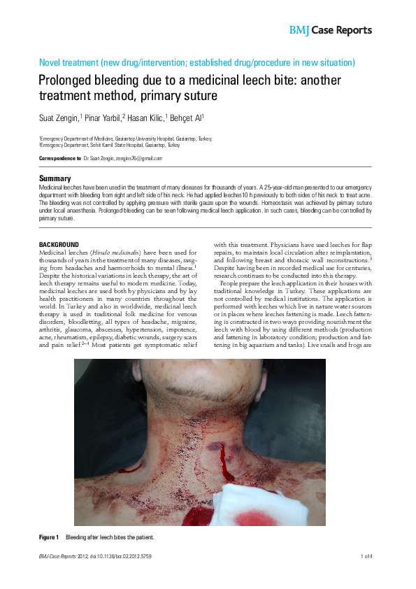 (PDF) Prolonged bleeding due to a medicinal leech bite: another ...