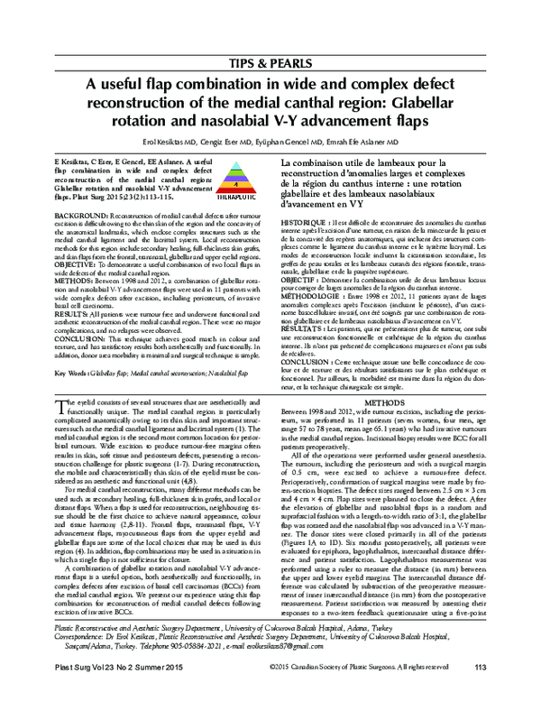 (PDF) Reconstruction of Medial Canthal Defects