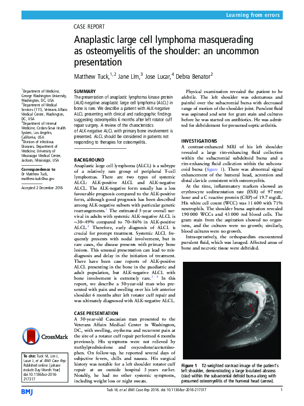 (PDF) Anaplastic large cell lymphoma masquerading as osteomyelitis of ...