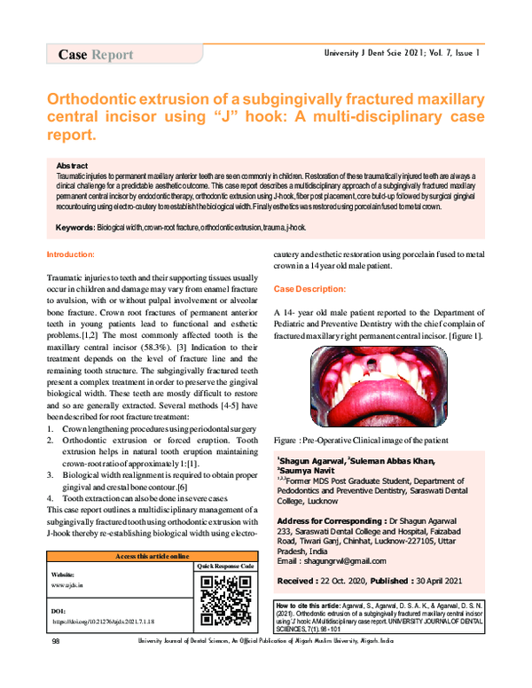 (PDF) Orthodontic extrusion of a subgingivally fractured maxillary ...